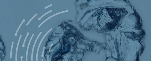 UPDATED: What are usance letters of credit | TFG 2022 Usance LC Guide